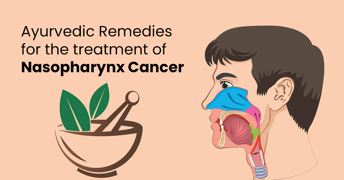 Nasopharyngeal Cancer Symptoms Causes And Treatment Nasopharyngeal ...