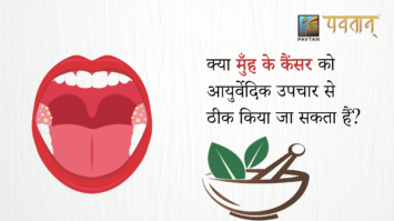 क्या मुँह के कैंसर को आयुर्वेदिक उपचार से ठीक किया जा सकता हैं? - Pavtan